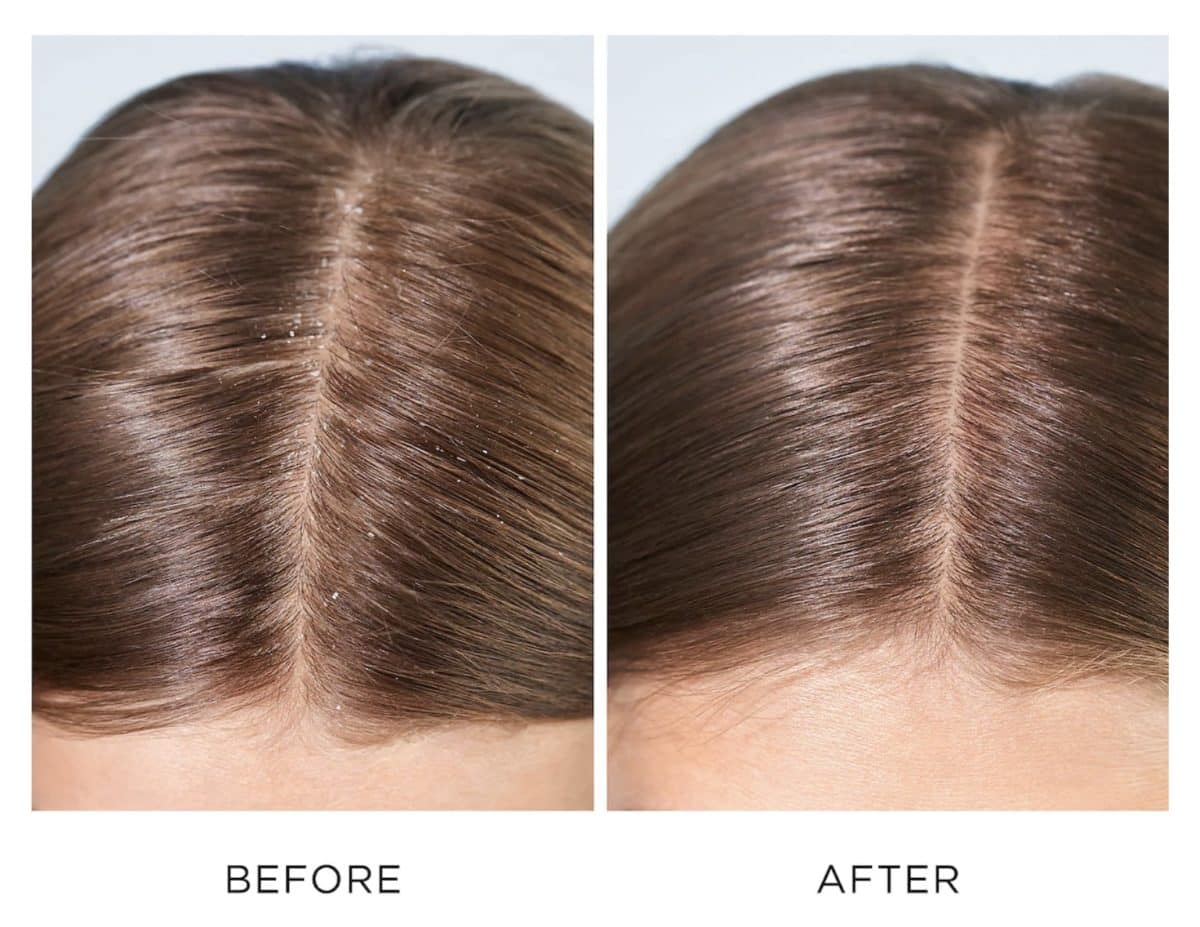 Briogeo Hair Care Review - Must Read This Before Buying