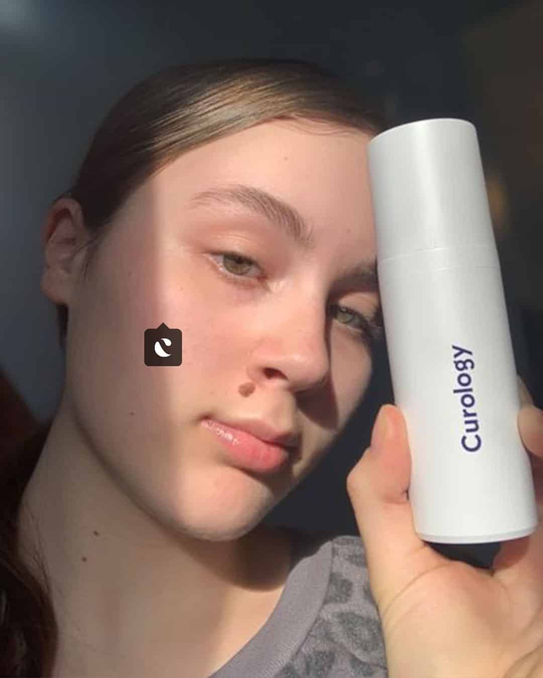 Curology Review - Must Read This Before Buying