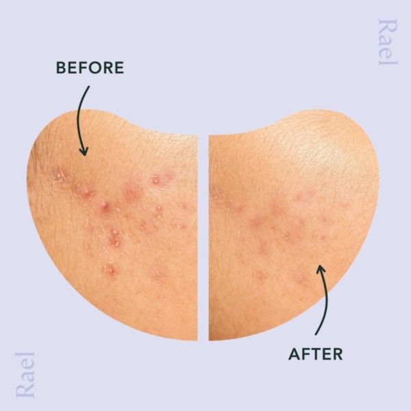 Rael Pads Review - Must Read This Before Buying