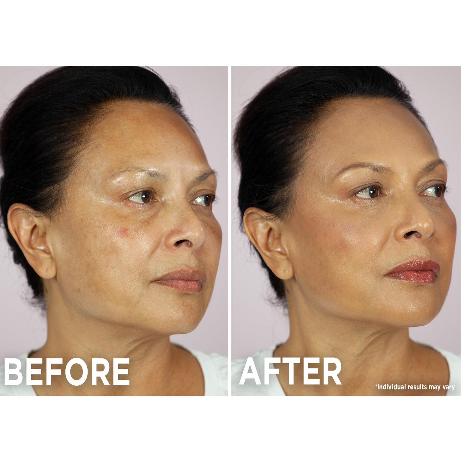 Beverly Hills MD Review - Must Read This Before Buying