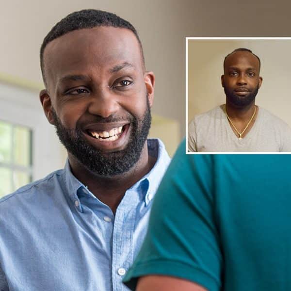 Hair Club Review - Must Read This Before Buying