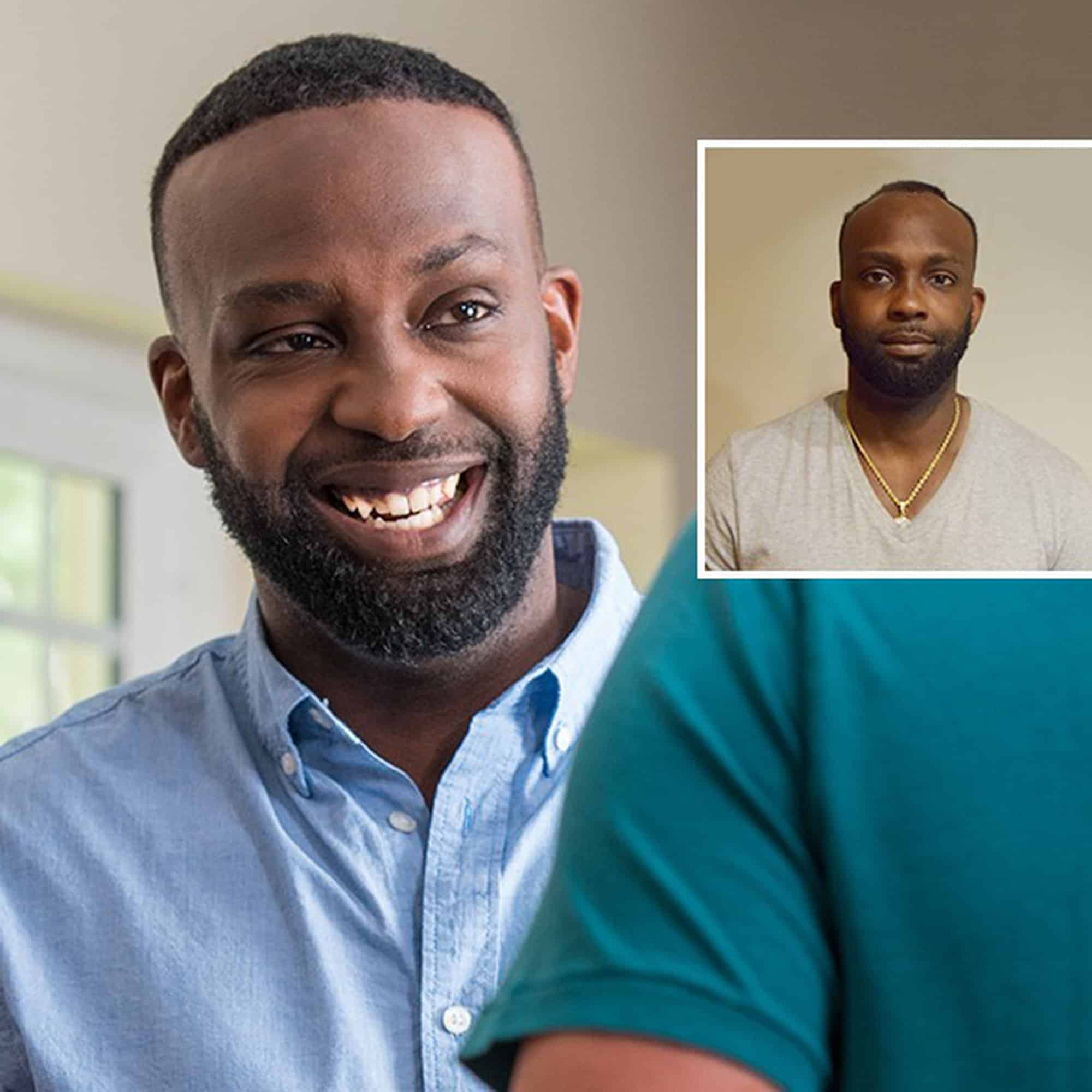 Hair Club Review - Must Read This Before Buying