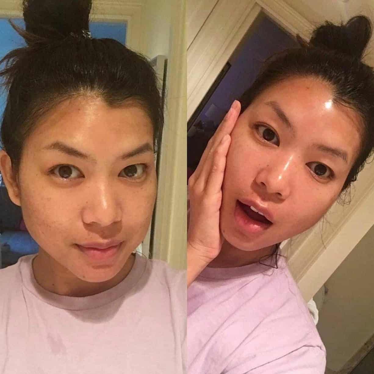 Hanacure Mask Review - Must Read This Before Buying