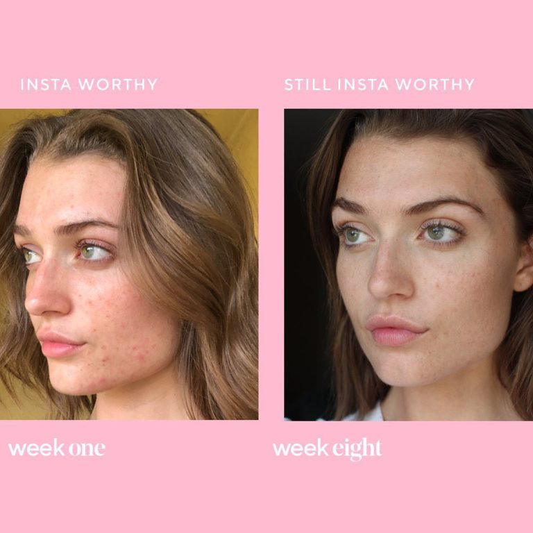 Murad Skincare Review - Must Read This Before Buying