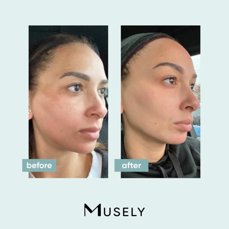 Musely Skincare Review - Must Read This Before Buying