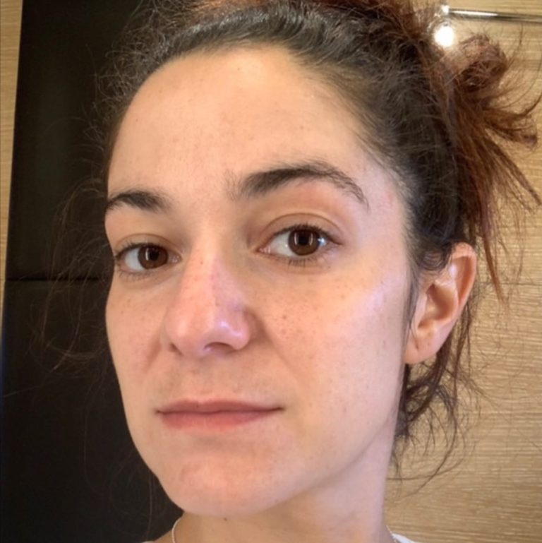 Musely Skincare Review - Must Read This Before Buying