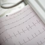 Life Line Screening Review - Must Read This Before Buying