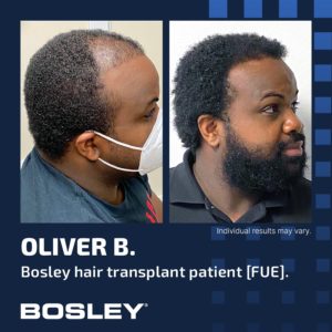 Bosley Hair Review - Must Read This Before Buying