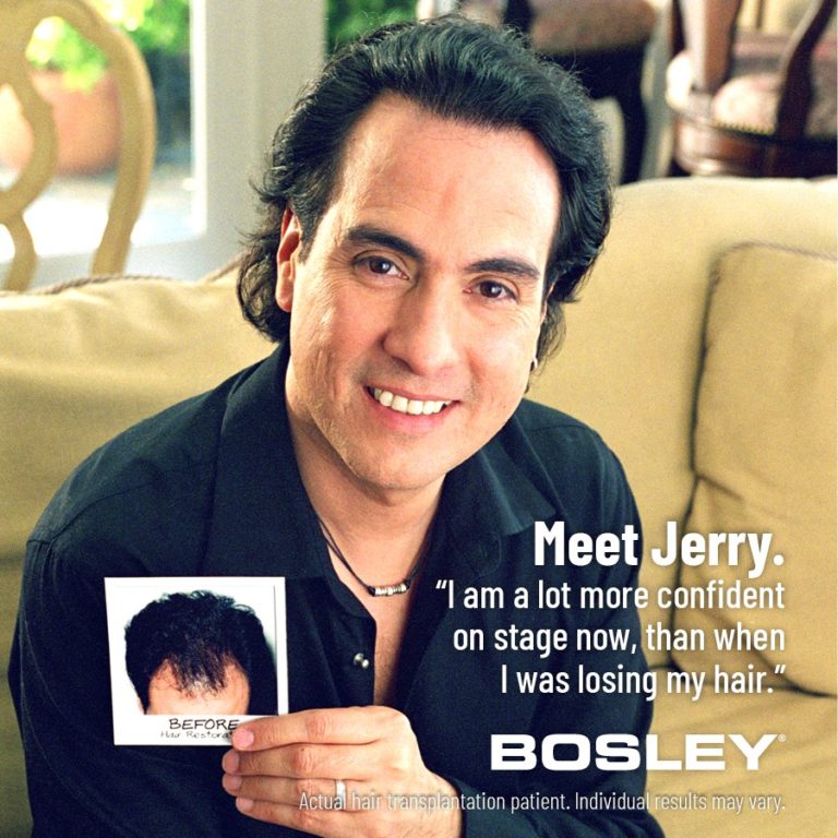 Bosley Hair Review - Must Read This Before Buying