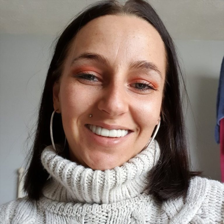 Instasmile Review - Must Read This Before Buying