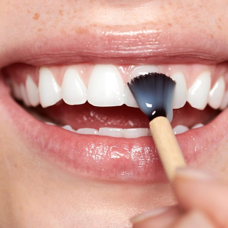 vVARDIS Review - Must Read This Before Buying