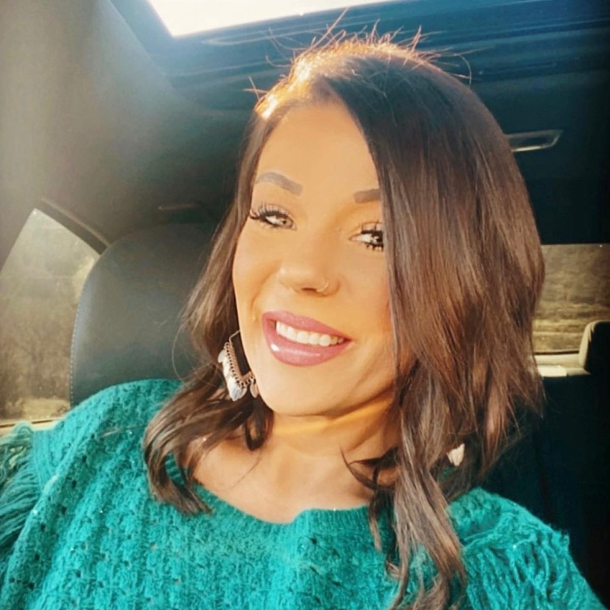 Shiny Smile Snap On Veneers Review - Must Read This Before Buying