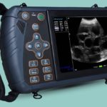 Wellue Review - Must Read This Before Buying