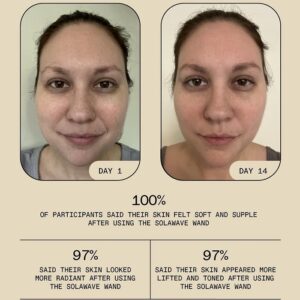 30 SolaWave Before and After Pictures - Must Read This Before Buying