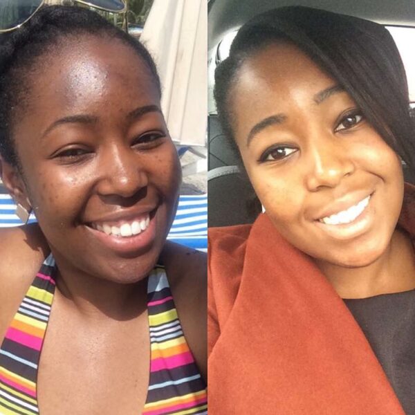 Kojic Acid Soap Before and After: Does It Really Lighten Skin? - Must ...
