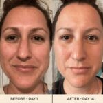 Red Light Therapy Before and After: Does It Really Work? - Must Read ...