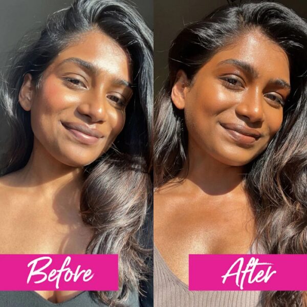 Retinol Before and After: Transform Your Skin with These Results - Must ...