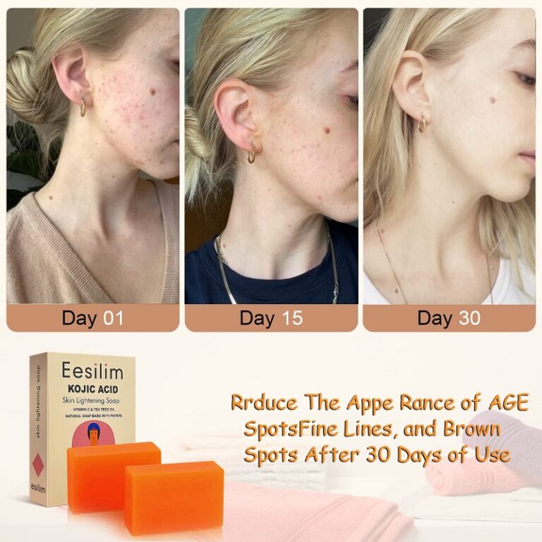 Kojic Acid Soap Before And After Does It Really Lighten Skin Must Read This Before Buying
