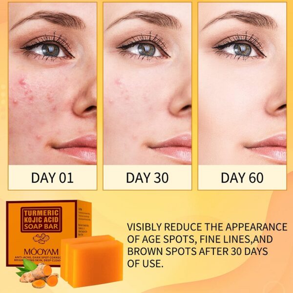 Kojic Acid Soap Before And After Does It Really Lighten Skin Must Read This Before Buying
