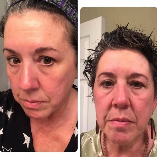 Modere Collagen Before and After: Real Results Revealed - Must Read ...