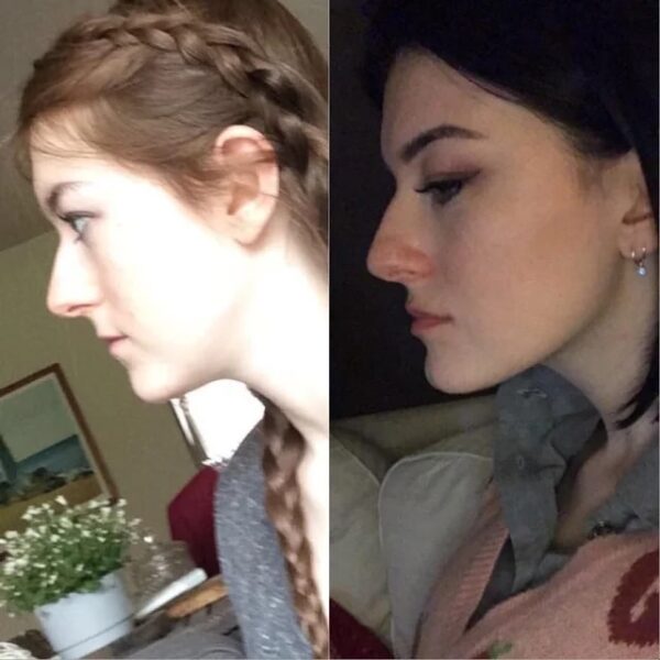 Mewing App Review - Must Read This Before Buying