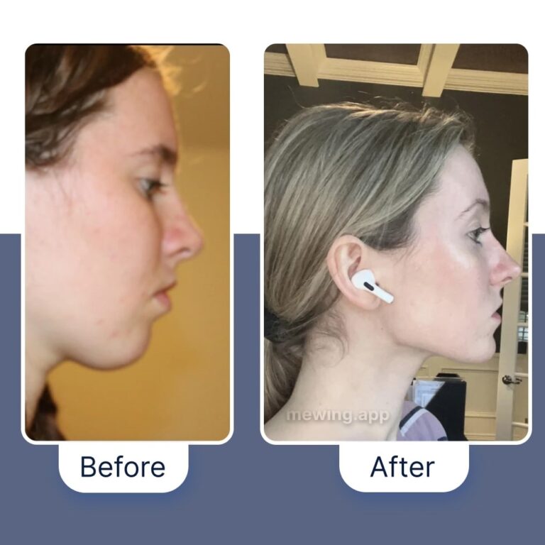 Mewing App Review - Must Read This Before Buying